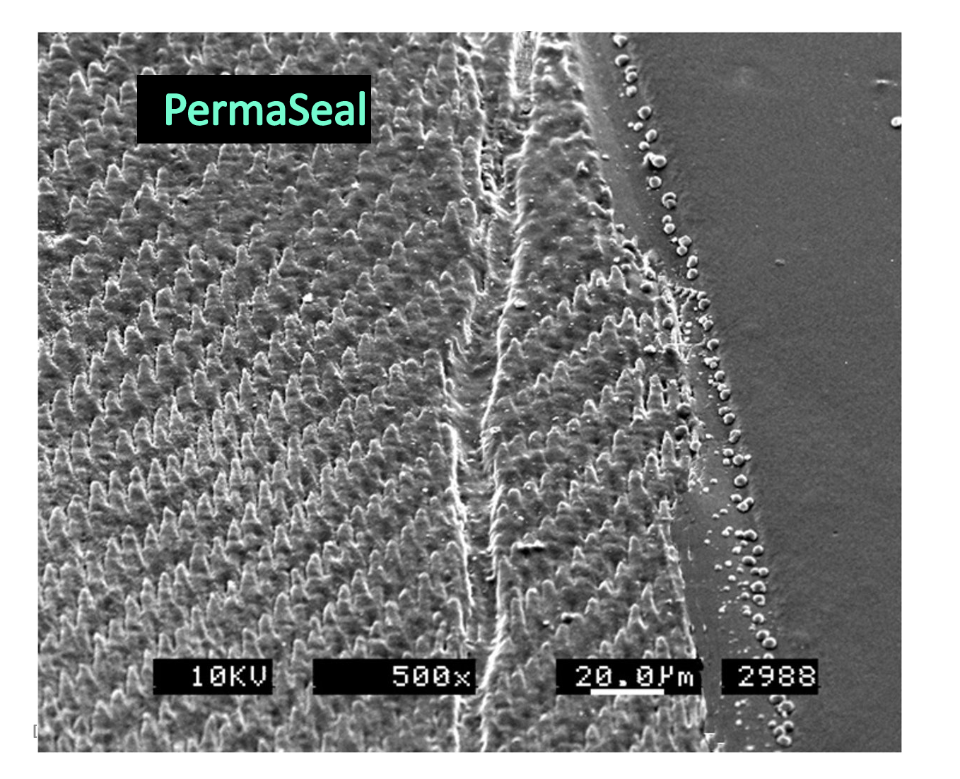 Avoid the White Line Around the Margins of Your Composite Restorations